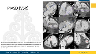 CARDIAC CT ANATOMY Book Reading Rahmat Muliawan | PPTX