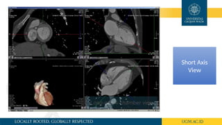 CARDIAC CT ANATOMY Book Reading Rahmat Muliawan | PPTX