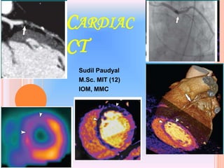 Cardiac CT | PPT