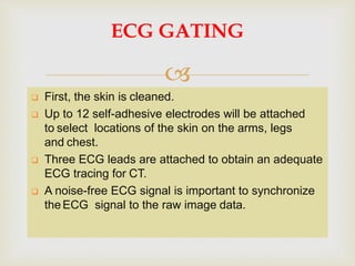 Coronary CT Angiography | PPTX