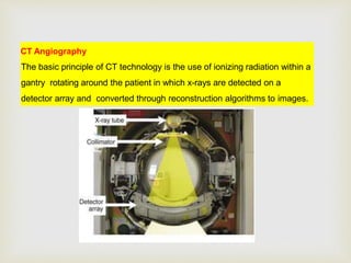 Coronary CT Angiography | PPTX