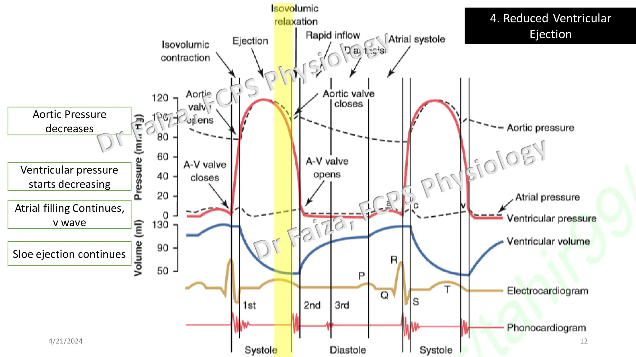 Cardiac Cycle Physiology Wiggers diagram.pdf