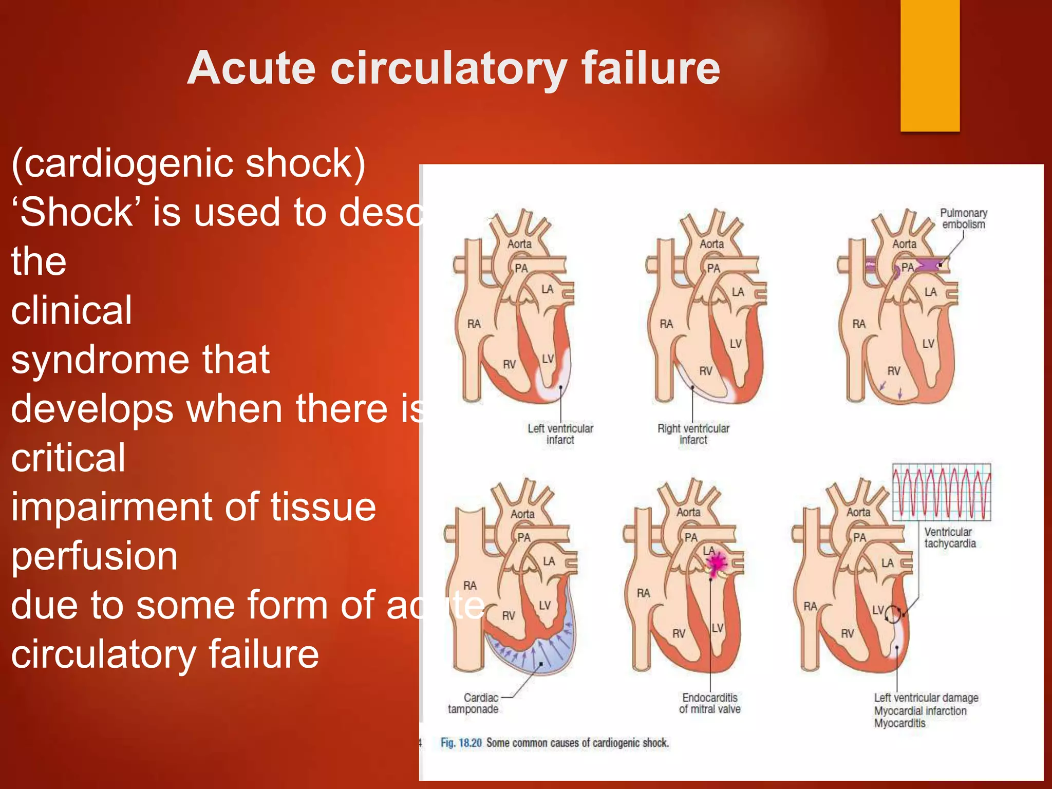 Cardiac cycle and its abnormality | PPTX