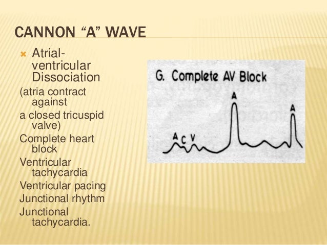 Cardiac cycle and jvp