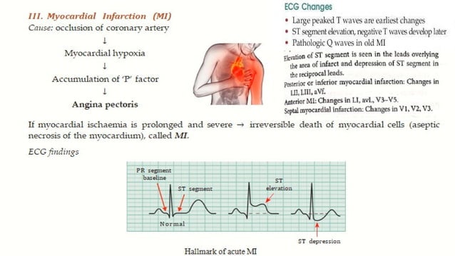 Cardiac cycle& ECG2.pptx BY DR K AMBAREESHA,. PHD | PPT