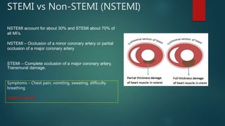 Cardiac cycle ecgs__murmurs | PPT