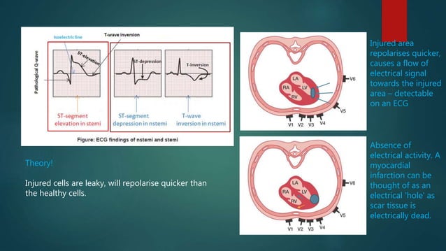 Cardiac cycle ecgs__murmurs | PPT