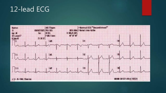 Cardiac cycle ecgs__murmurs | PPT