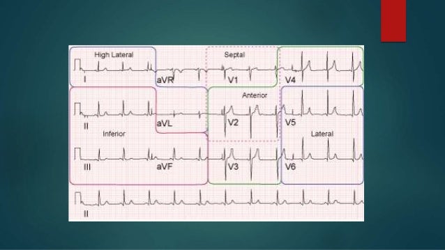 Cardiac cycle ecgs__murmurs