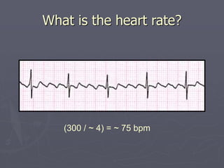 cardiac_cycle.ppt