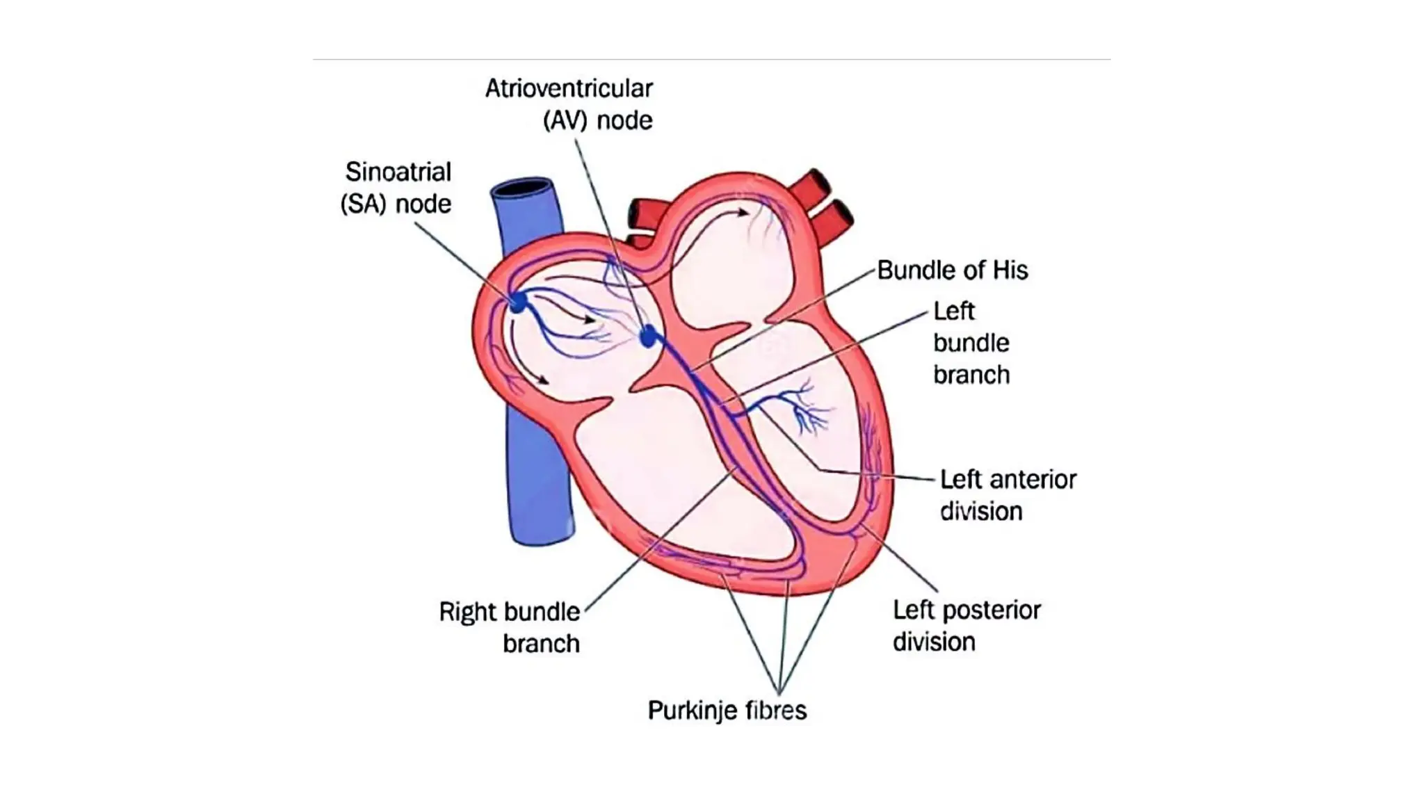 Cardiac Defibrillation & Cardioversion Principles and Basics ACCC 2024 ...