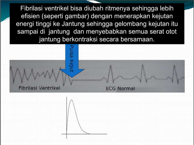 Cardiac Defibrillators 2022 NEW.pptx