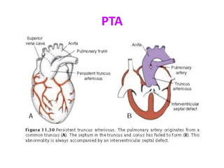 Cardiac development final | PPTX