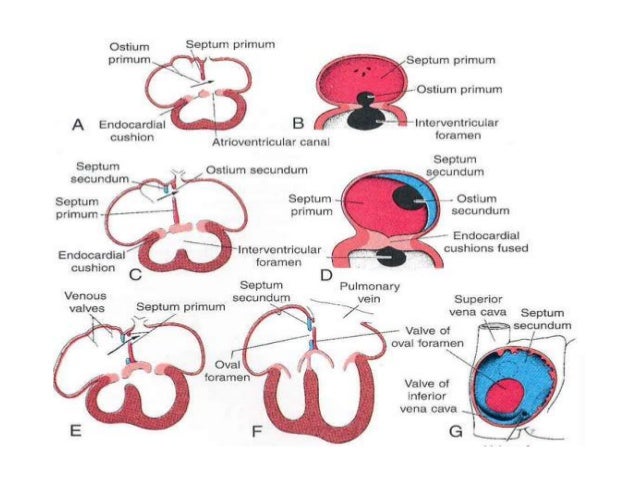 Cardiac development final