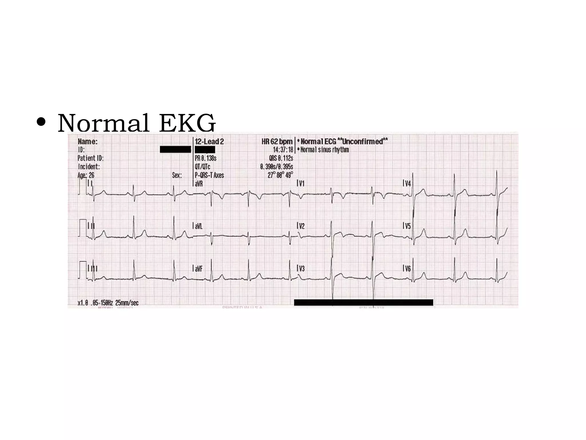 Cardiac diagnostic procedures | PPT