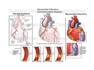 Cardiac disease | PPT