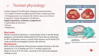 cardiacdiseaseduringpregnancyfin-230511221602-d720e371.pptx for Nursing ...