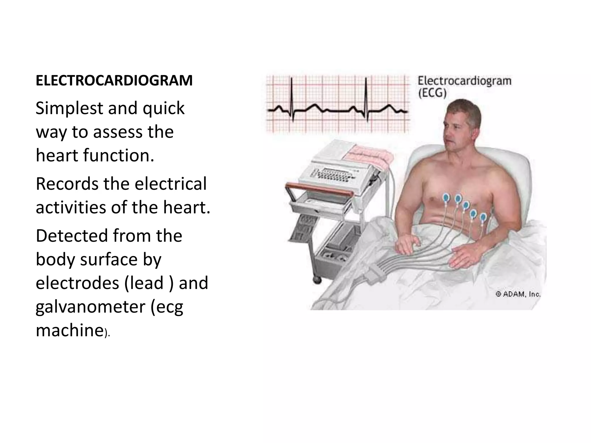 Cardiac disorder test | PPTX