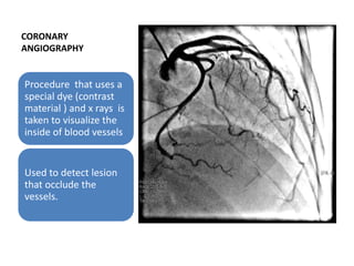 Cardiac disorder test | PPTX