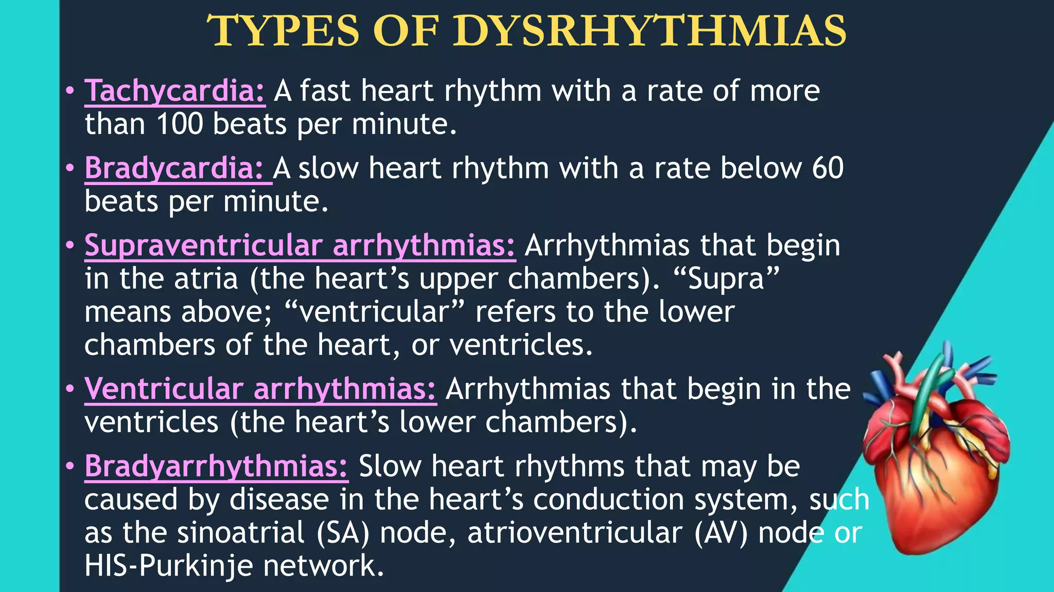 Cardiac dysrhythmias | PPTX