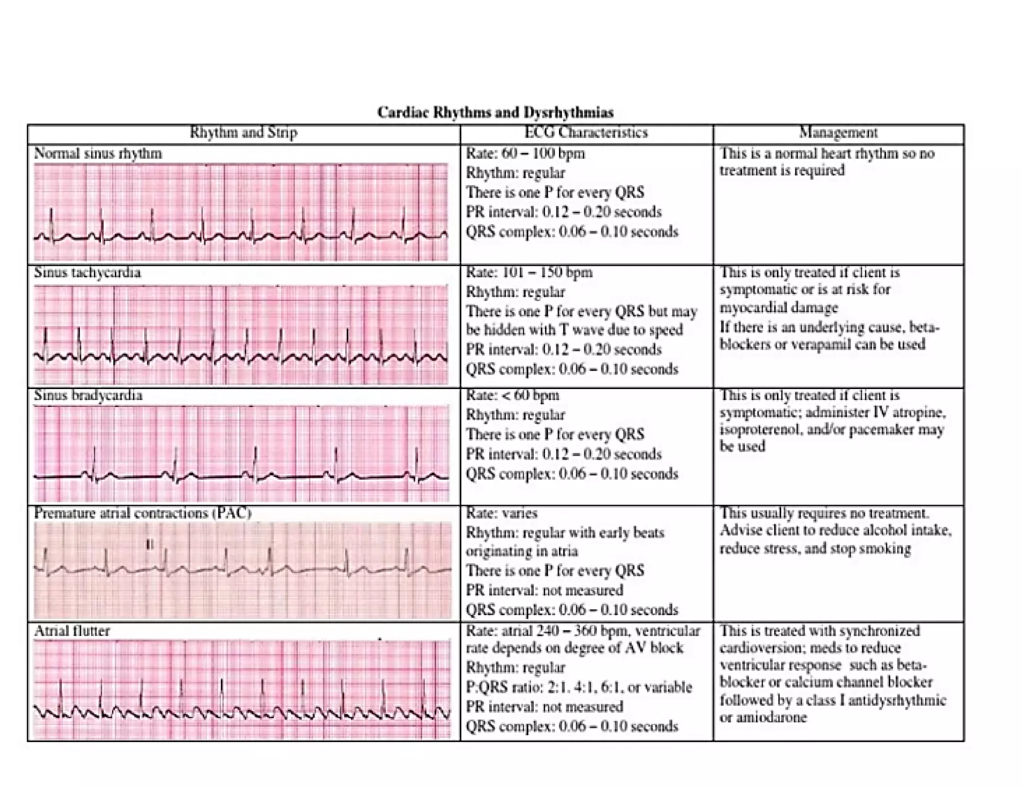 Cardiac dysrhythmias.pdf