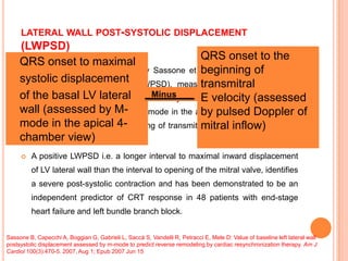 Cardiac dyssynchrony ppt by dr awadhesh | PPTX