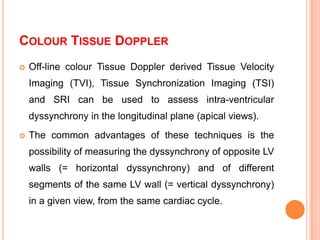 Cardiac dyssynchrony ppt by dr awadhesh | PPTX