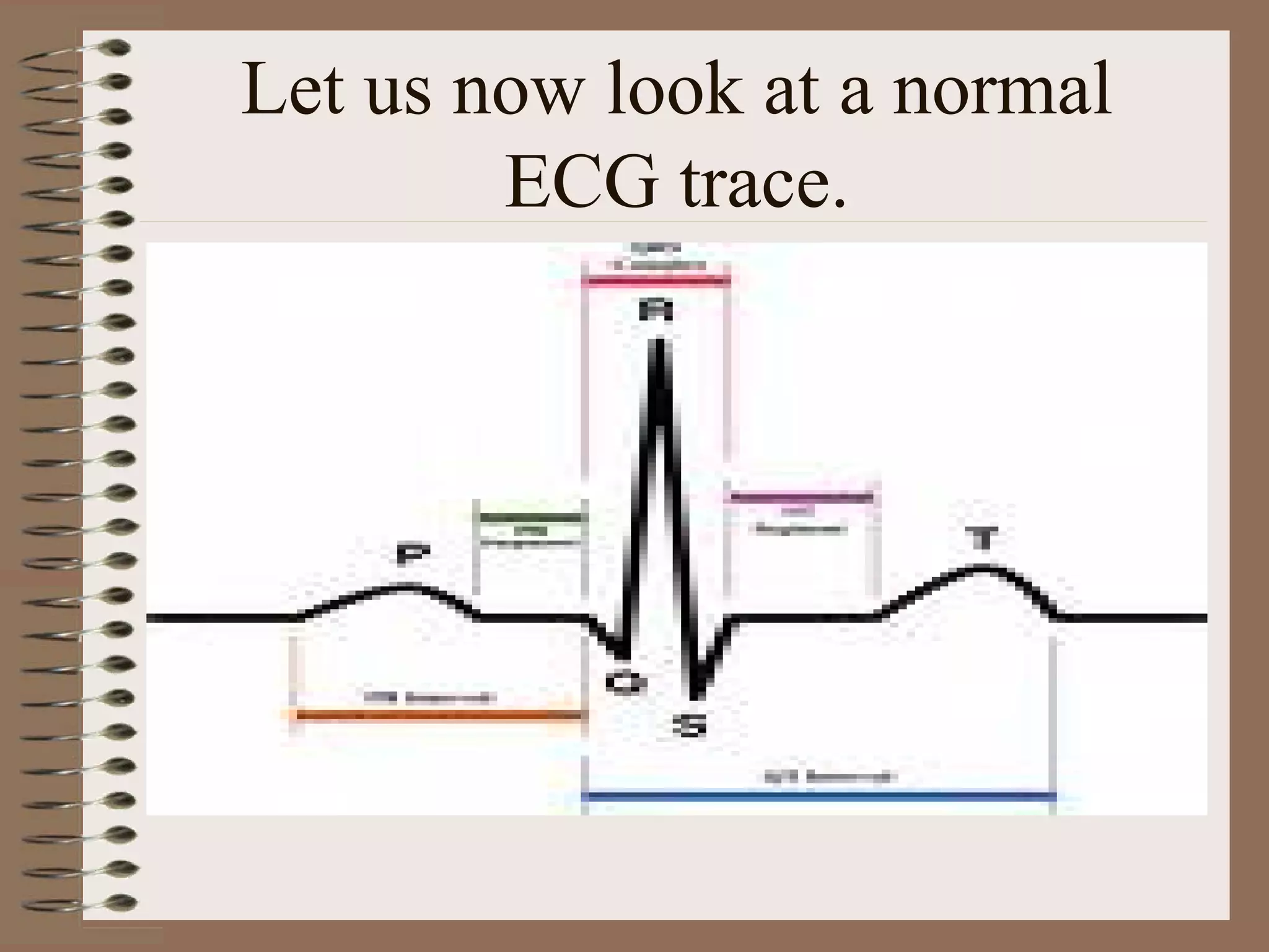 Cardiac Ecg Interpretation | PDF