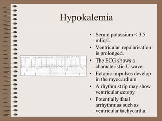 Cardiac Ecg Interpretation | PDF