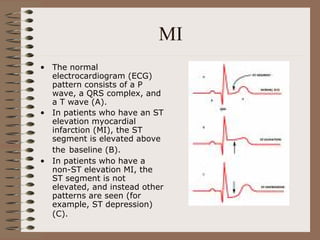 Cardiac Ecg Interpretation | PDF