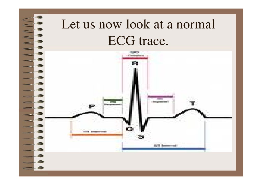 Cardiac Ecg Interpretation