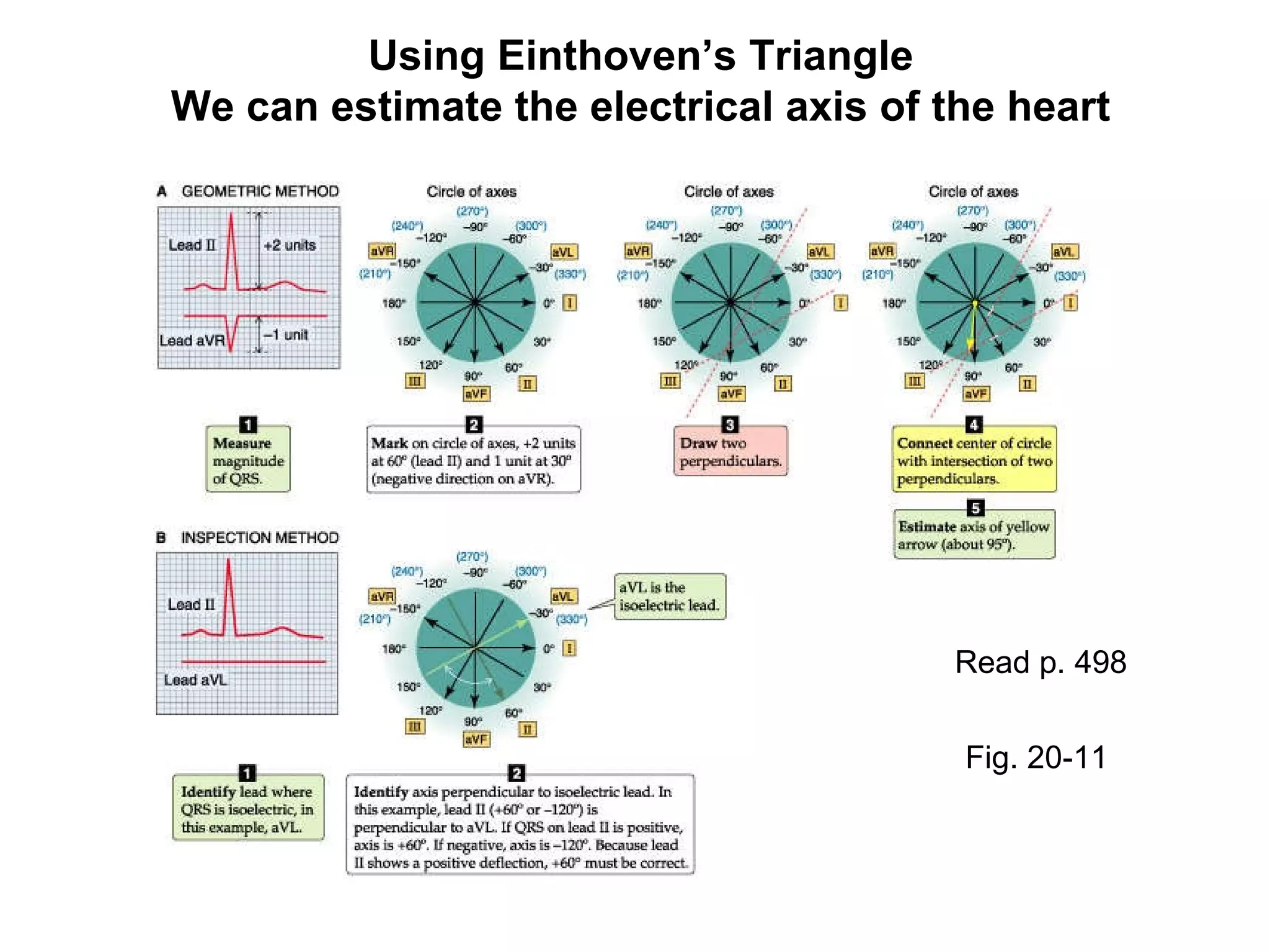Cardiac electrophysiology part ii lecture 4 | PPT