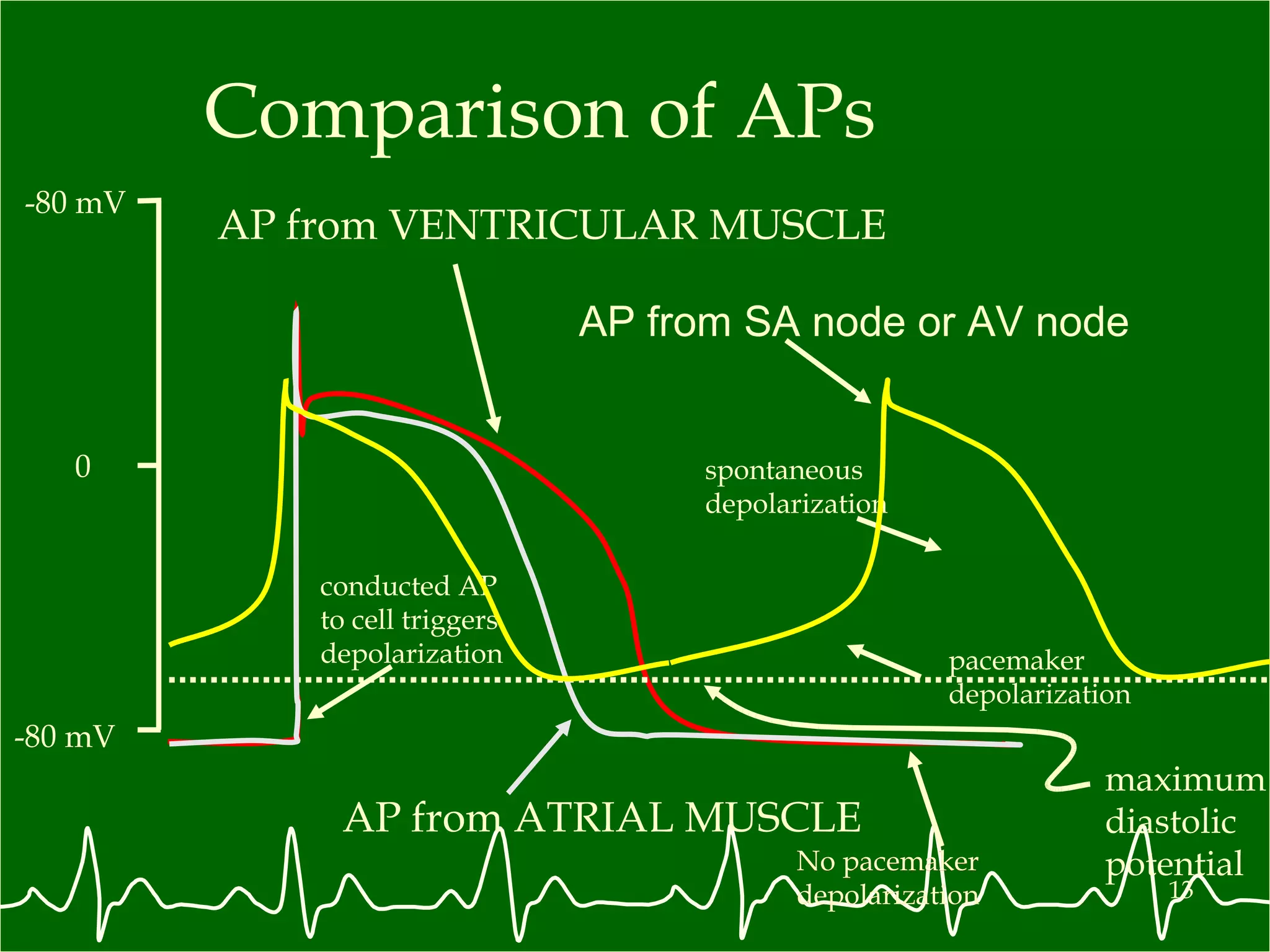 Cardiac+Electrophysiology | PPT