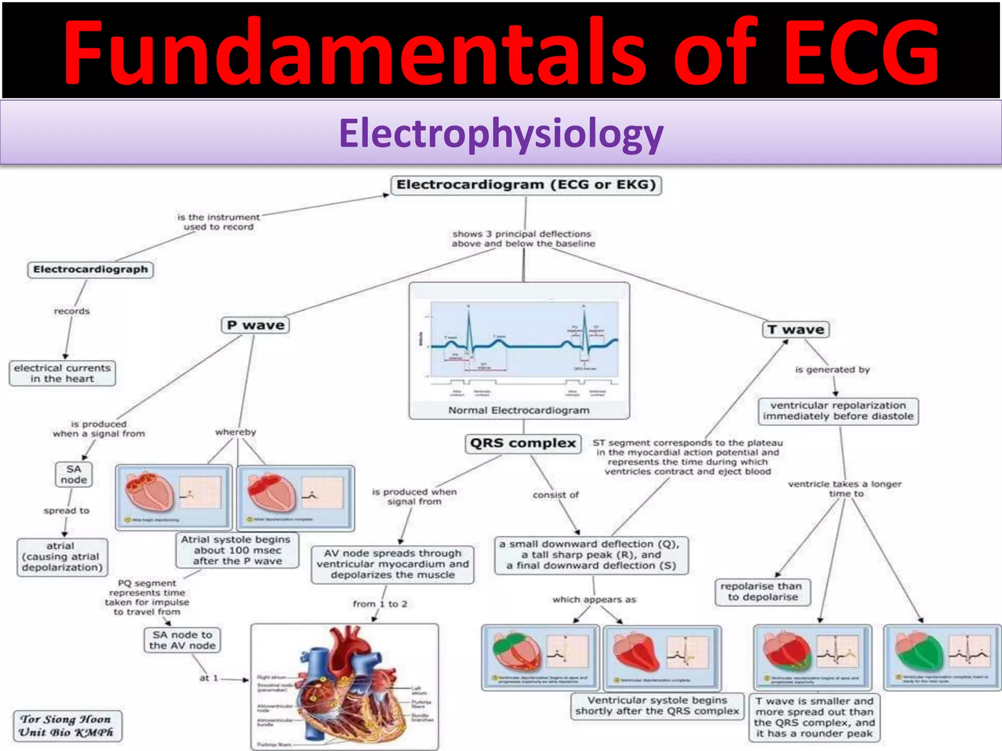 Cardiac electrophysiology master class | PPSX