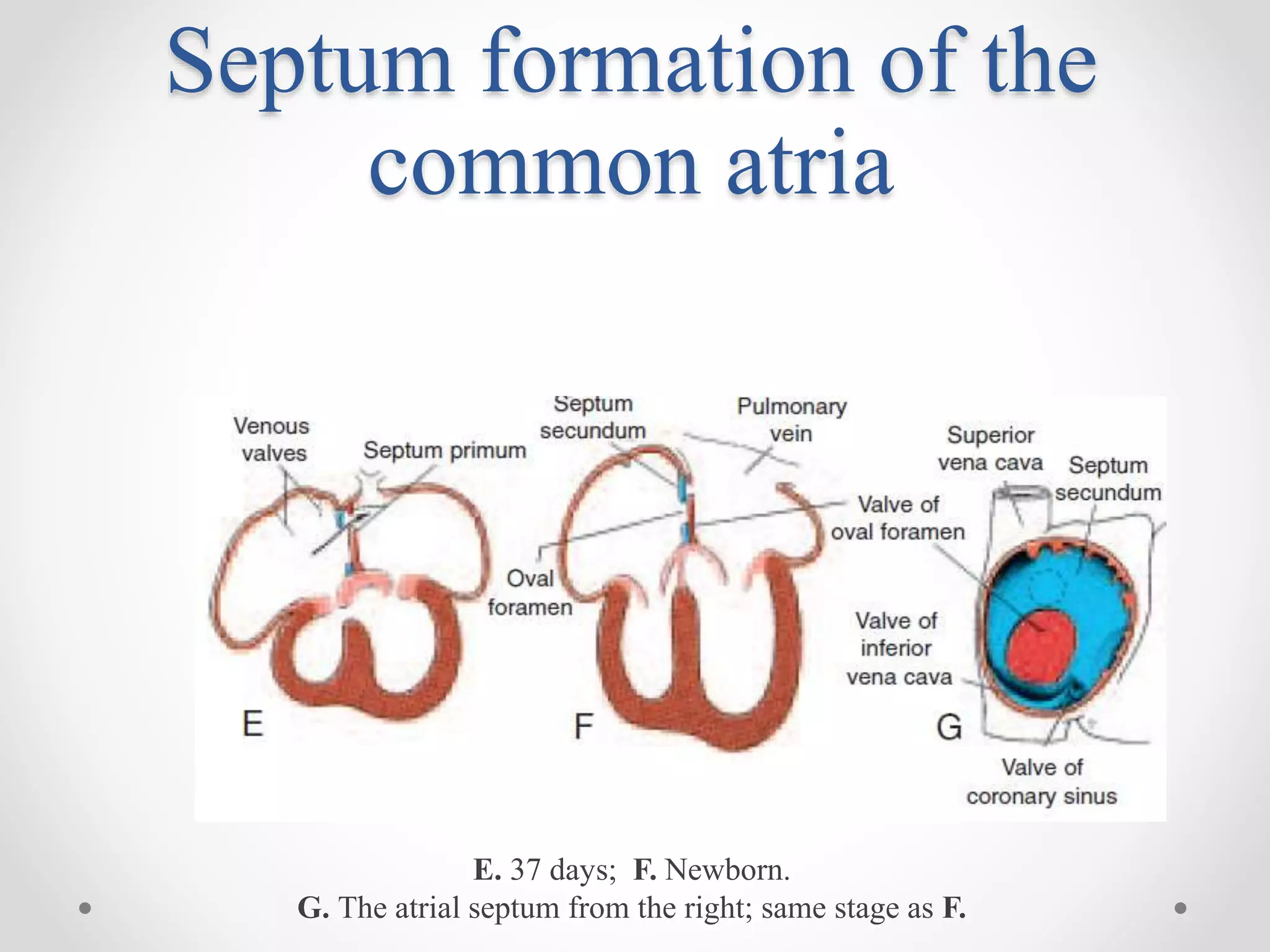 Cardiac Embryology basics.pptx