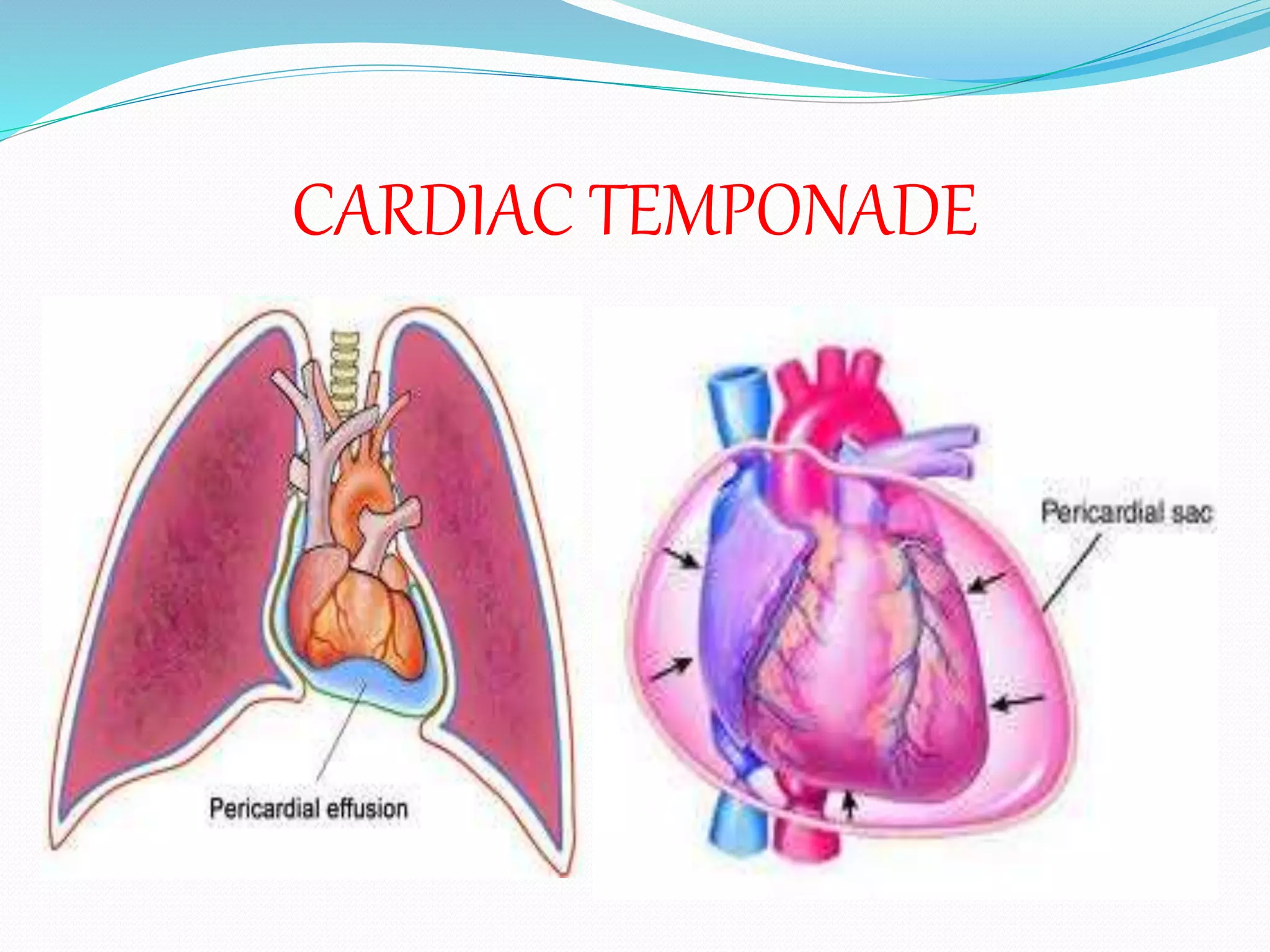 Cardiac emergencies | PPTX