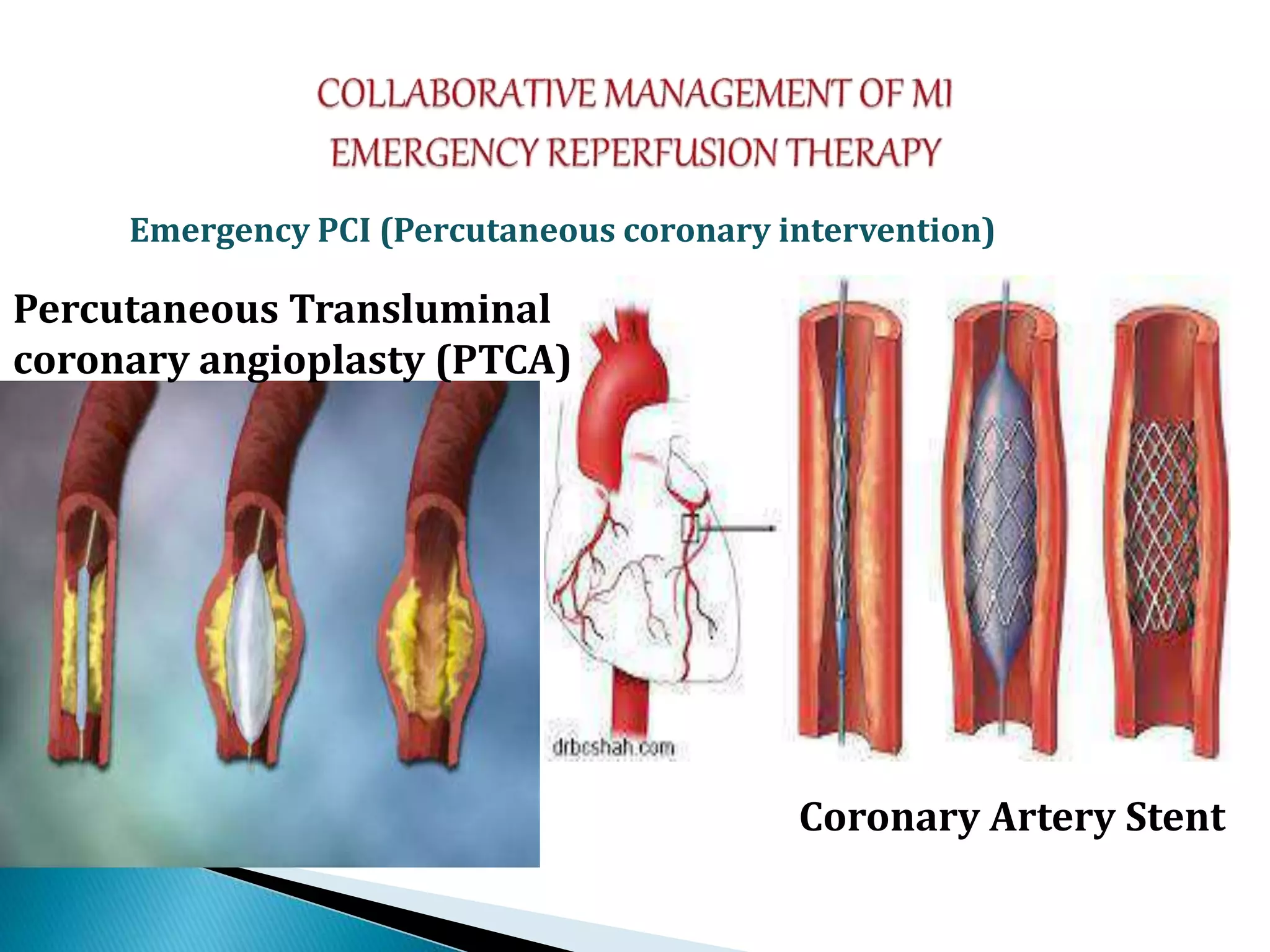 CARDIAC EMERGENCY | PPTX