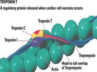 cardiac enzyme (1).pptx NURSING GOOD VERY | PPTX
