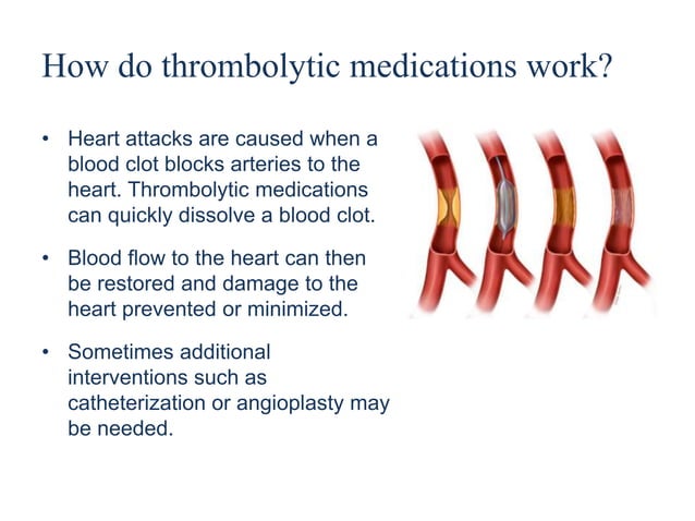 Cardiac enzymes, ligation and stripping, and thrombolytic therapy ...