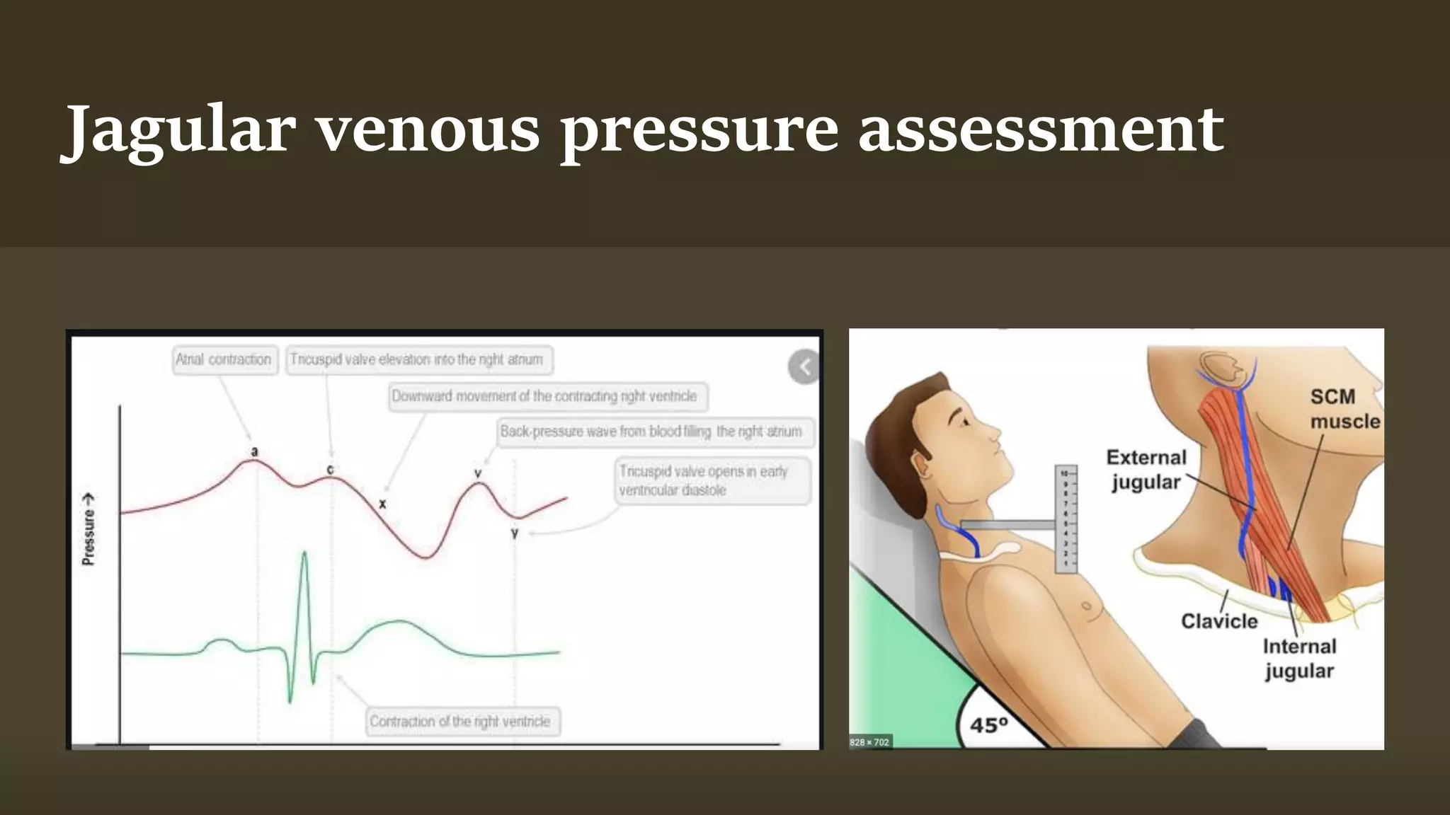 Cardiac exam | PPTX