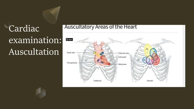 Cardiac exam | PPT