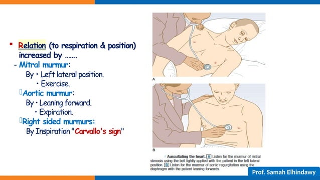 Cardiac examination.pptx.ppt in children | PPT