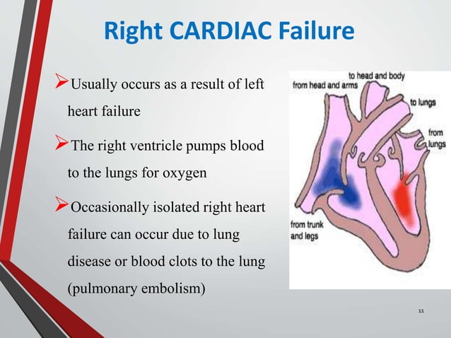 Cardiac failure | PPT