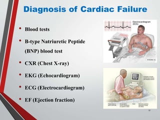 Cardiac failure | PDF | Heart and Cardiovascular Diseases | Diseases ...