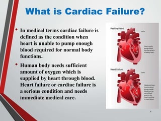 Cardiac failure | PDF | Heart and Cardiovascular Diseases | Diseases ...