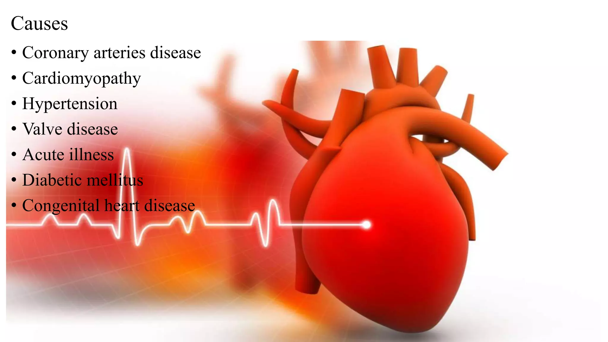 Cardiac failure | PPT