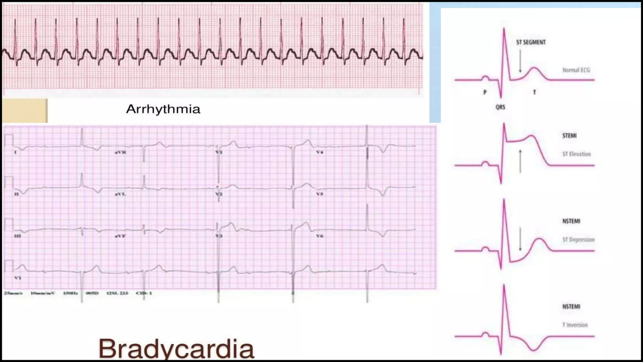 Cardiac function tests | PPTX