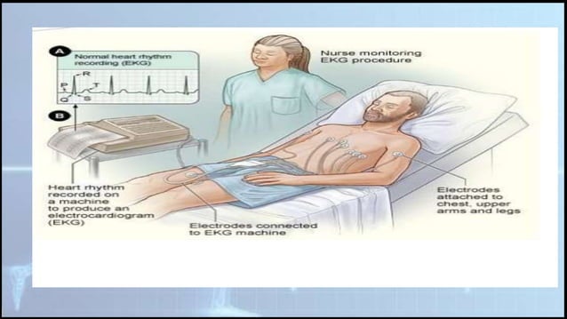 Cardiac function tests | PPTX | Heart and Cardiovascular Diseases ...