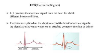 cardiac function tests and interpretation of results | PDF
