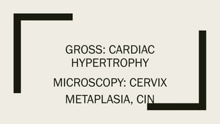 cardiac hypertrophy & CIN dysplasia metaplasia .pptx